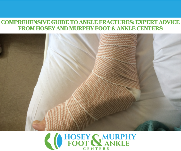 Comprehensive Guide to Ankle Fractures:Expert Advice from Hosey and ...